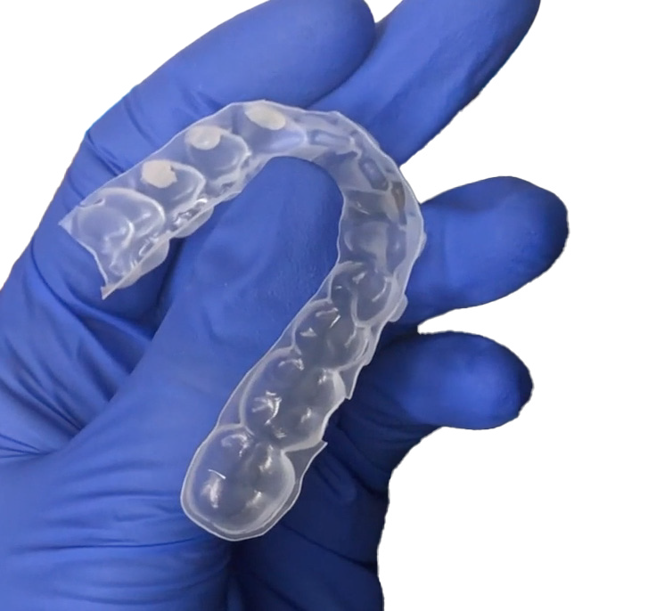 Ormco - Spark™ - Innovative & Advanced Clear Aligner System