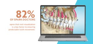 Spark™ - Doctor Site - Innovative & Advanced Aligner System