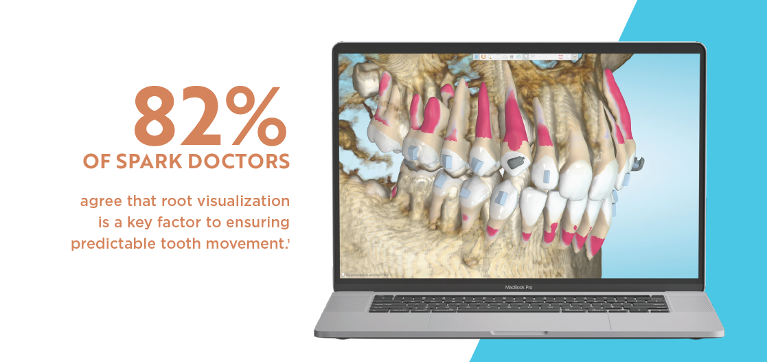 Spark™ - Doctor Site - Innovative & Advanced Aligner System