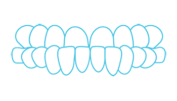 Ormco - Spark™ - Innovative & Advanced Clear Aligner System