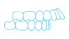 Ormco - Spark™ - Innovative & Advanced Clear Aligner System
