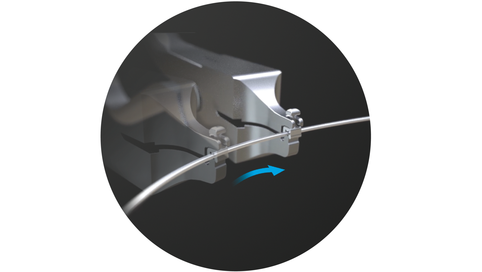 Ormco - Damon Ultima - The First True Full Expression System