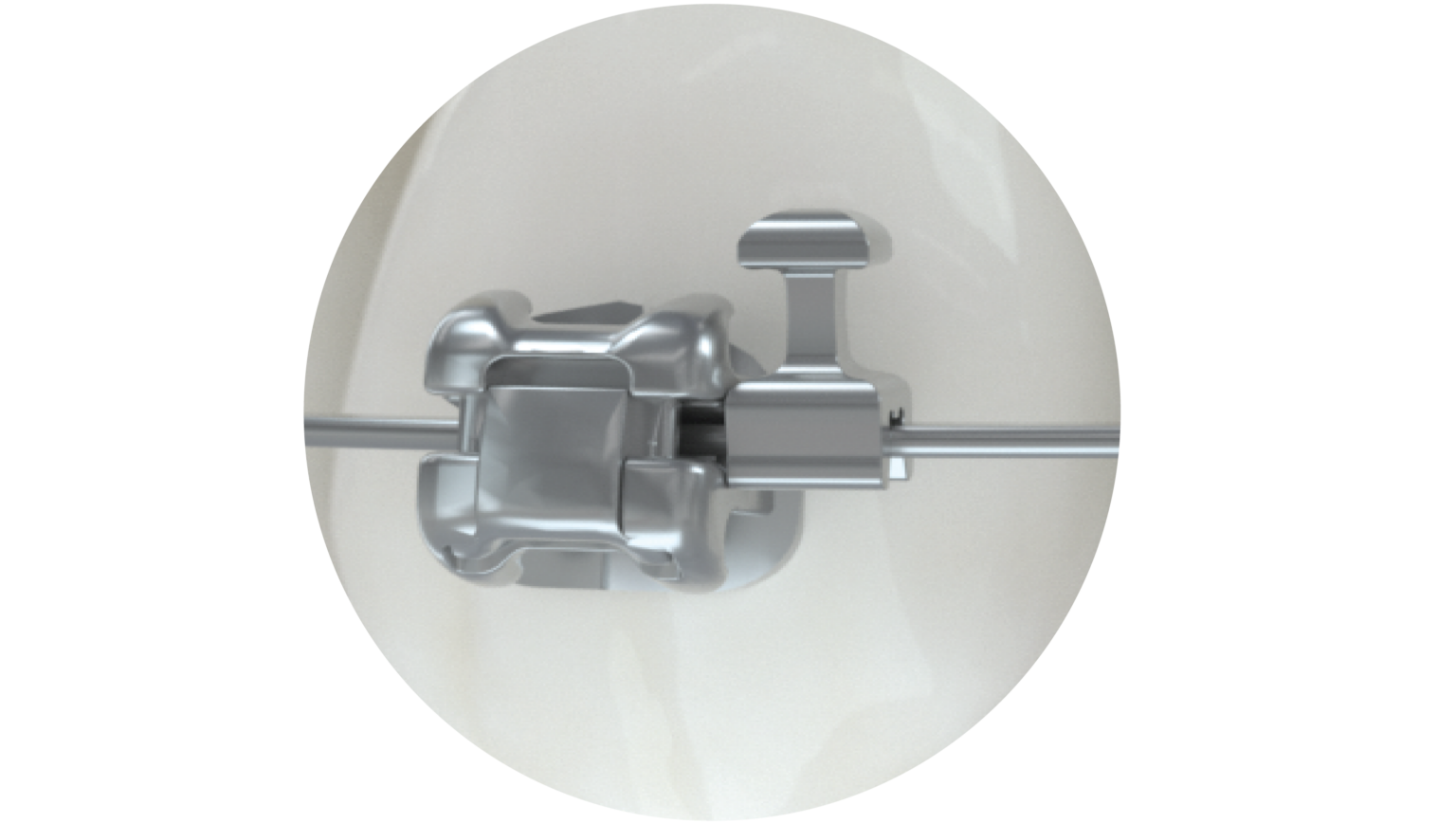 Ormco - Damon Ultima - The First True Full Expression System