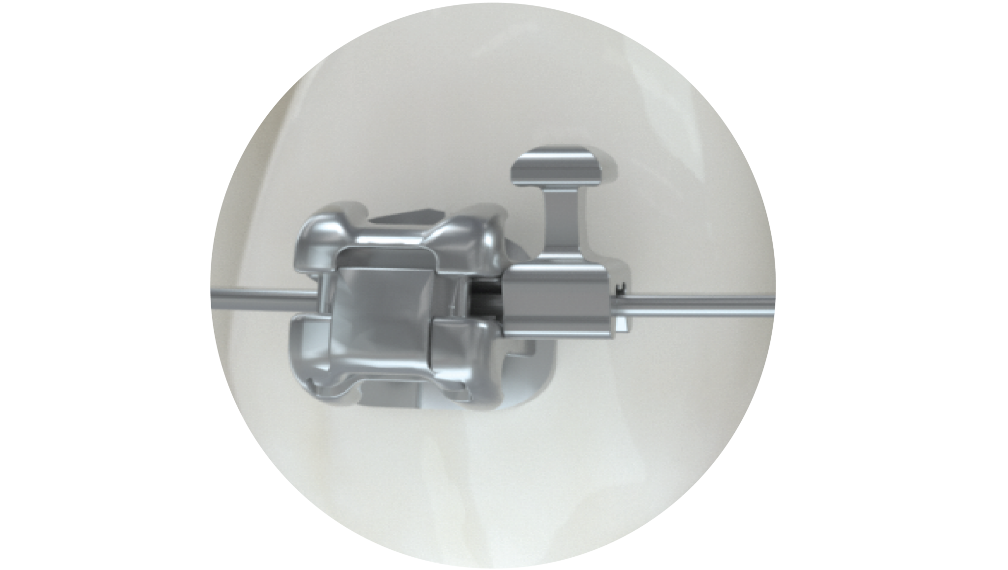 Ormco - Damon Ultima - The First True Full Expression System