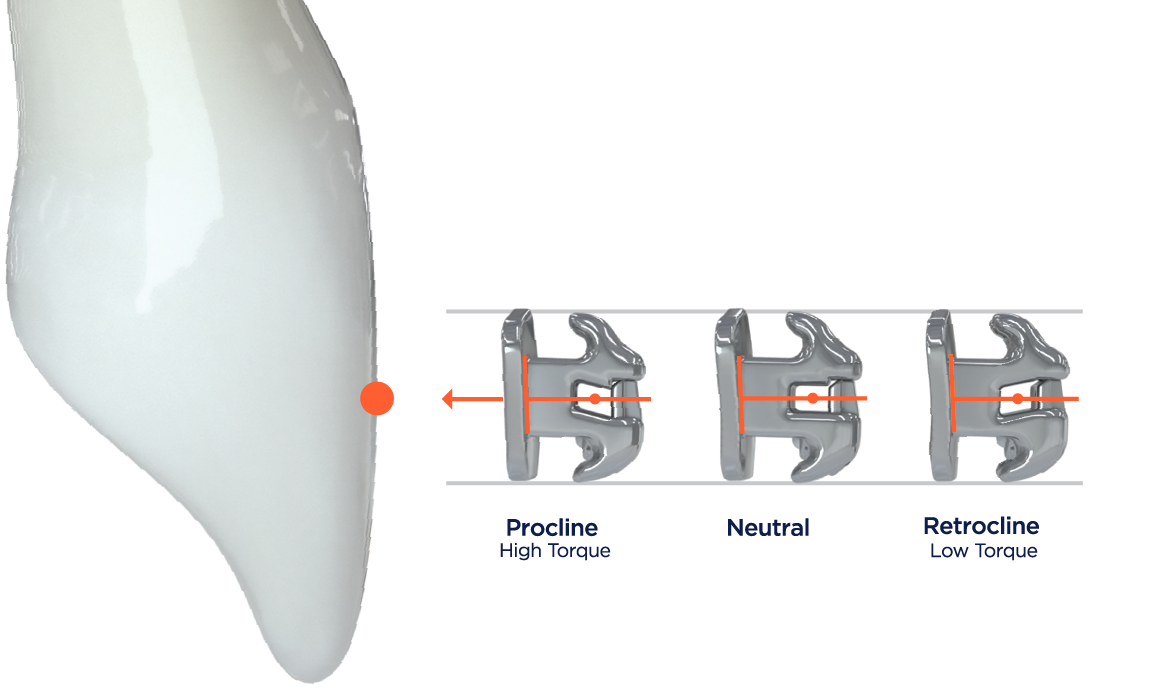 Ormco - Damon Ultima - The First True Full Expression System