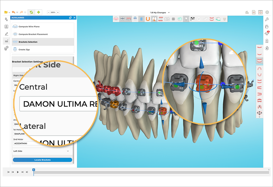 Ormco Digital Bonding - A Single Portal for Submitting Cases