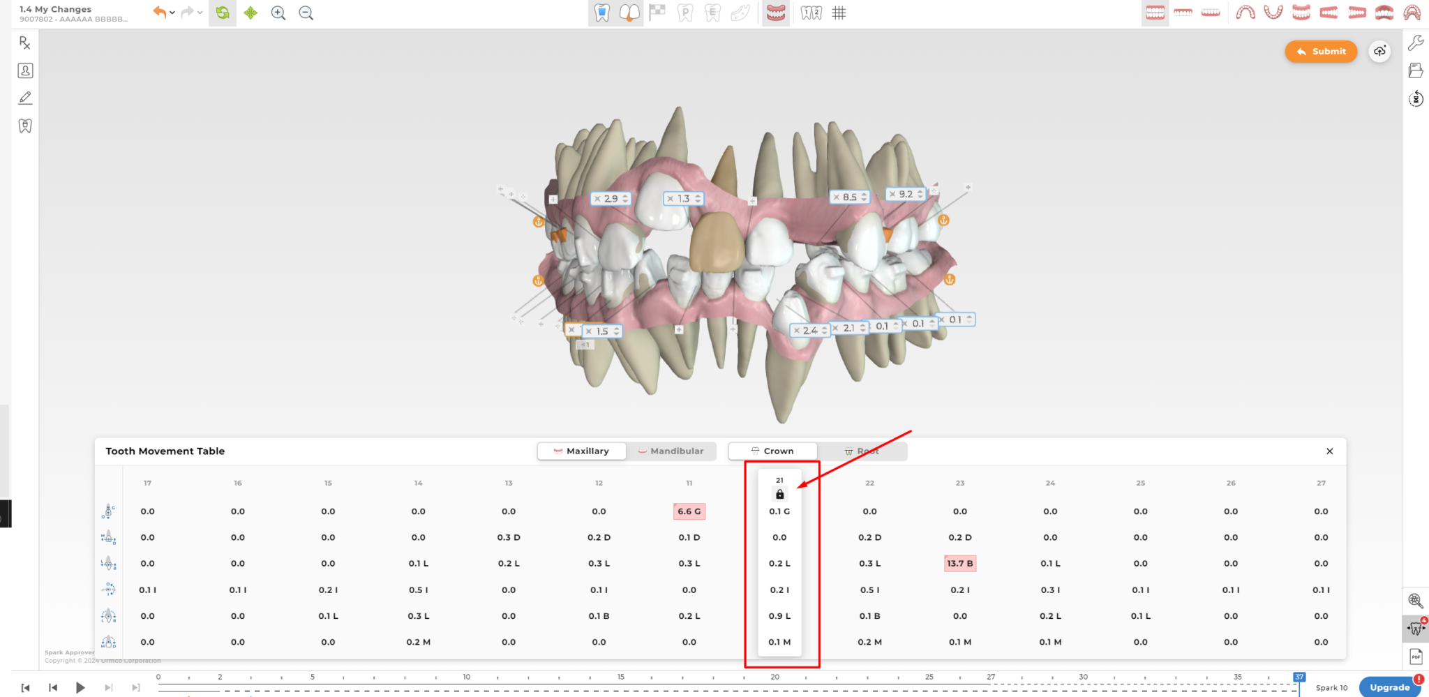 Spark release - Ormco