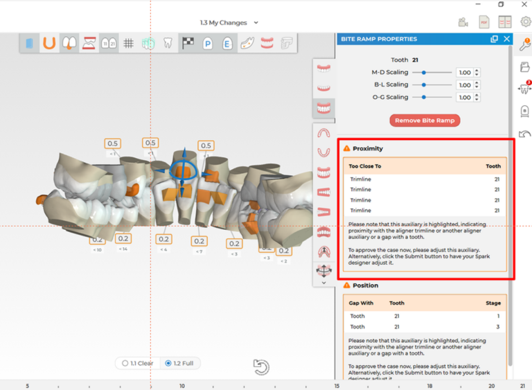 Ormco - Spark™ Releases - Latest Updates on Spark Aligners