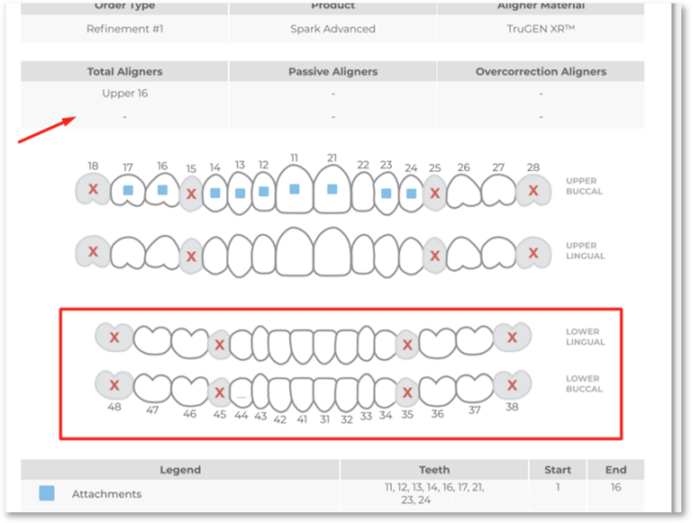 Ormco - Spark™ Releases - Latest Updates on Spark Aligners