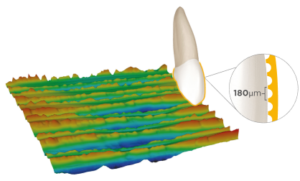 Spark™ - Doctor Site - Innovative & Advanced Aligner System