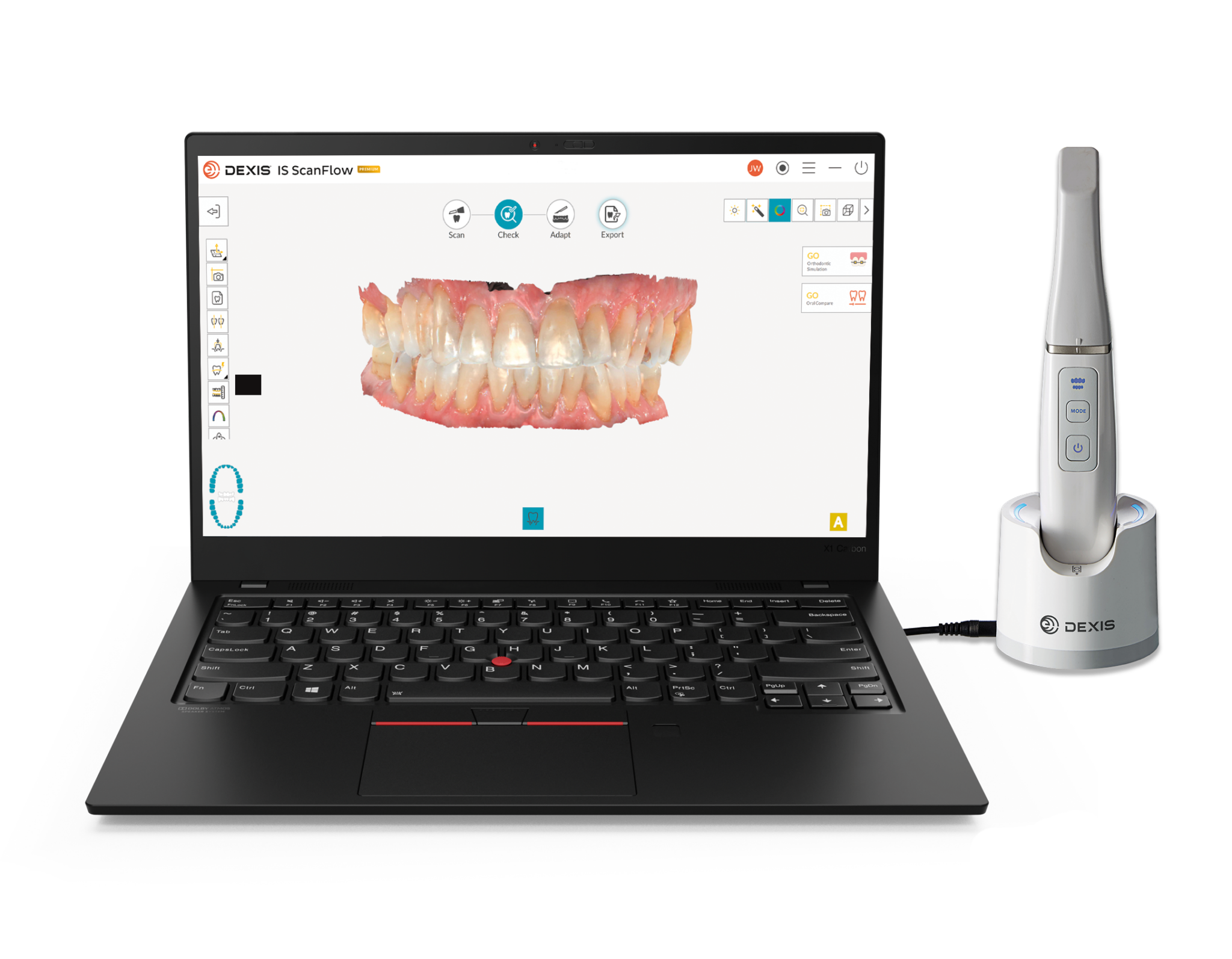 DEXIS™ Intraoral Scanners - Make Intraoral Scanning Simpler