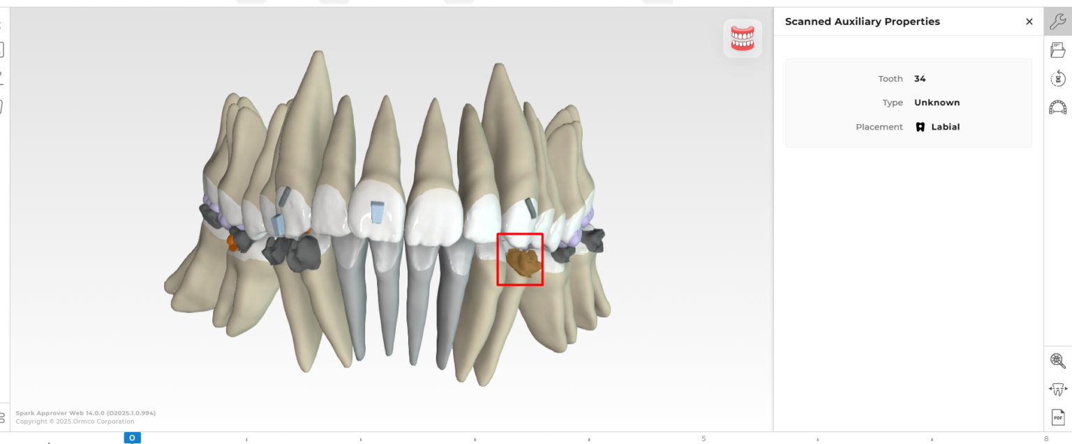 Ormco - Spark™ Releases - Latest Updates on Spark Aligners