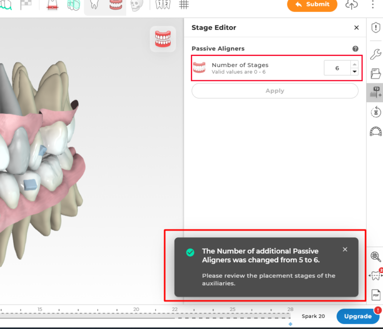 Ormco - Spark™ Releases - Latest Updates on Spark Aligners