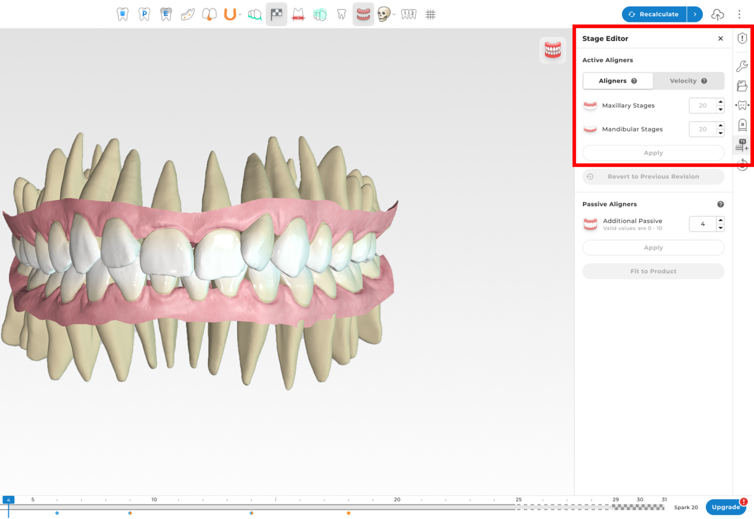 Ormco - Spark™ Releases - Latest Updates on Spark Aligners
