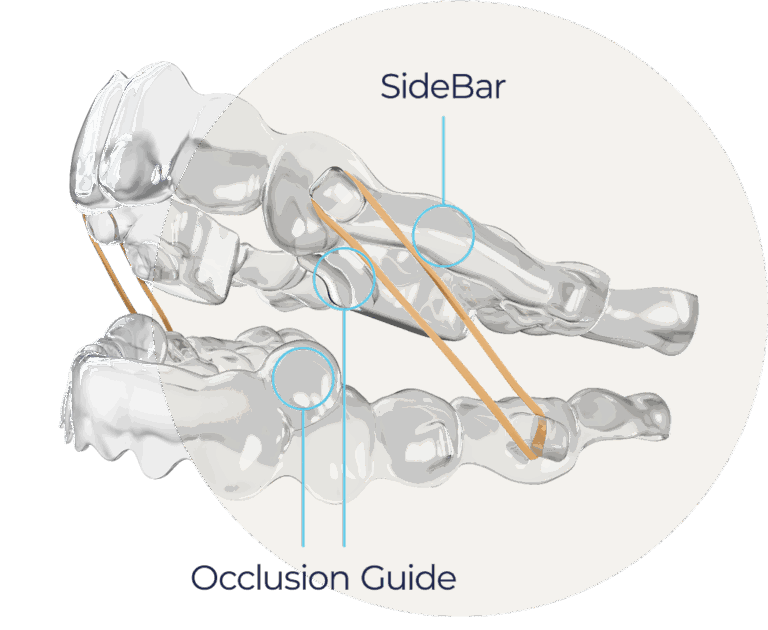 Spark™ Junior - Doctor Site - Clear Aligners for Growing Patients
